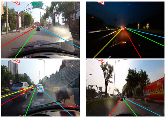 A Faster and Lightweight Lane Detection Method in Complex Scenarios