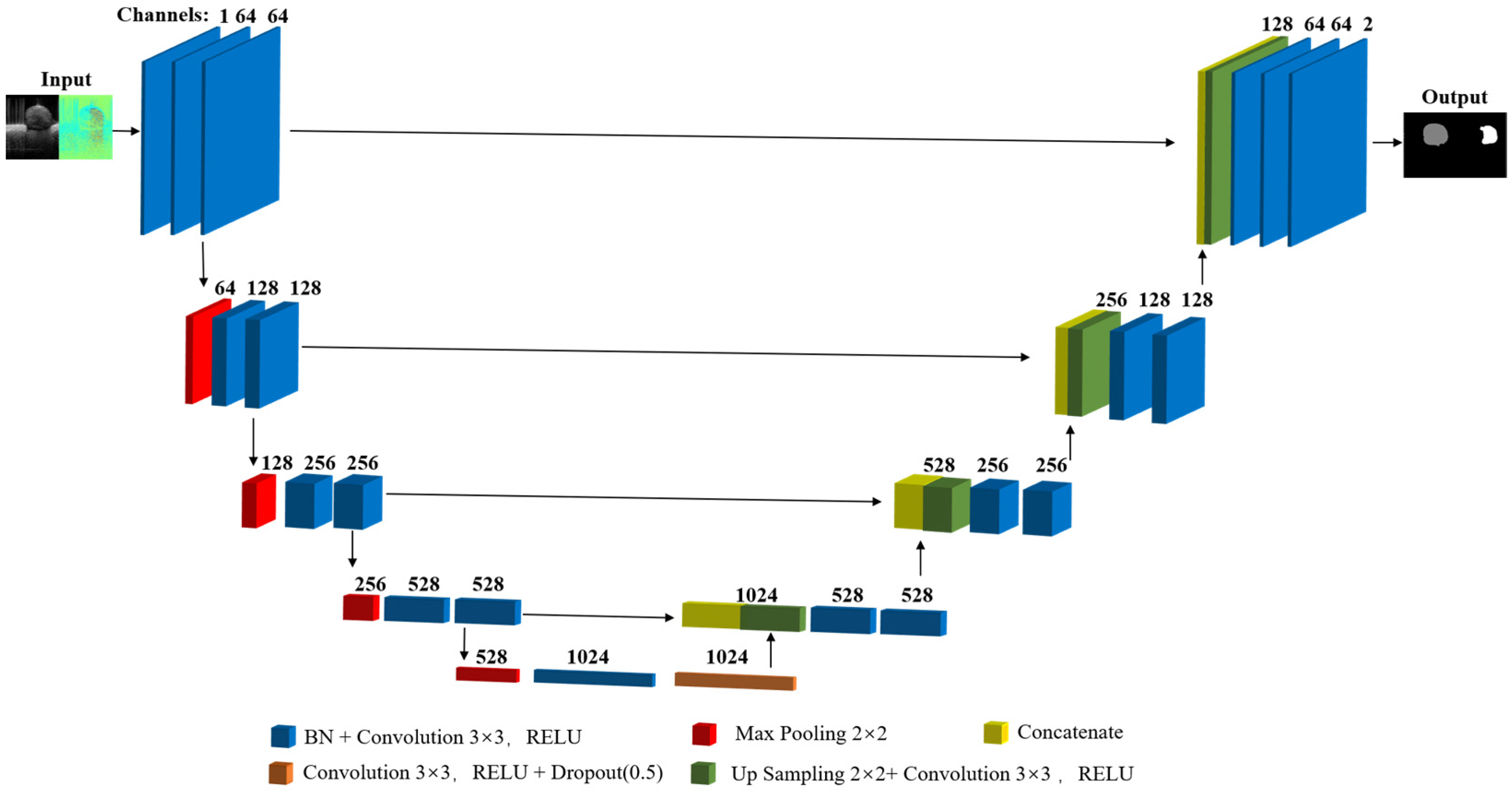 Electronics | Free Full-Text | Boundary Segmentation of Vascular Images ...