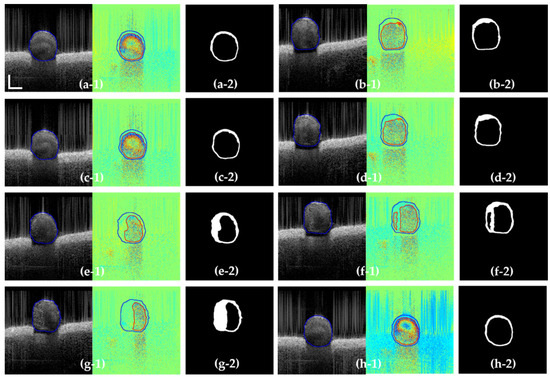 Boundary Segmentation of Vascular Images in Fourier Domain Doppler ...
