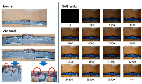 Electronics | Free Full-Text | A Study on GAN-Based Car Body Part ...
