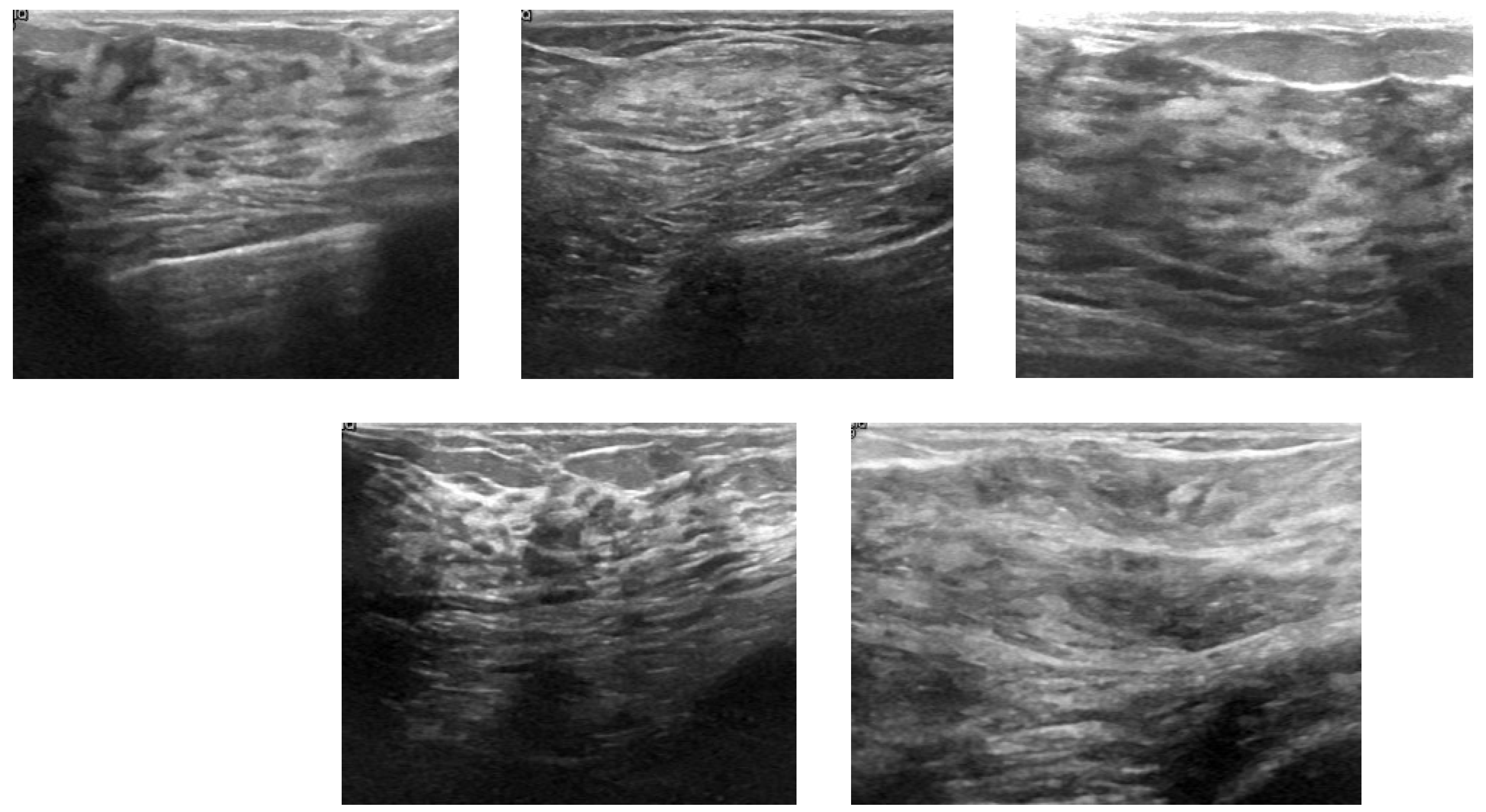 Enhancing Medical Image Denoising: A Hybrid Approach Incorporating Adaptive Kalman Filter and ...