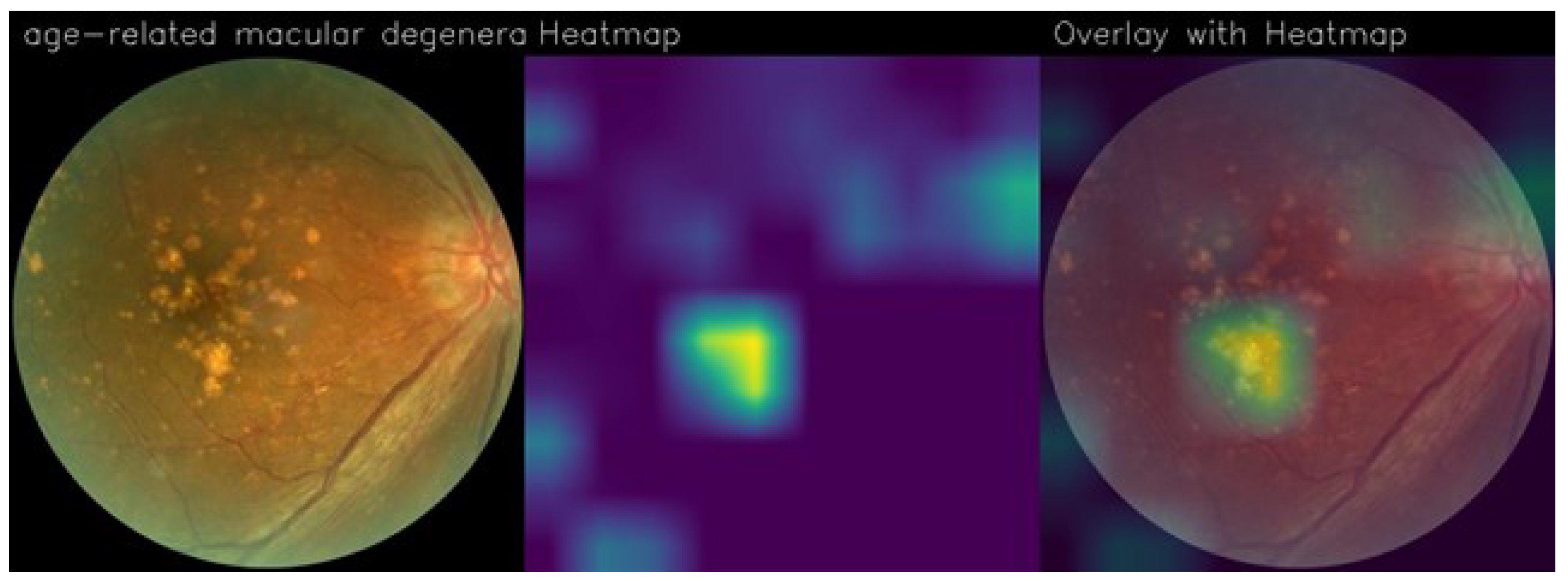 Electronics | Free Full-Text | A Method for Ocular Disease Diagnosis through Visual Prediction ...