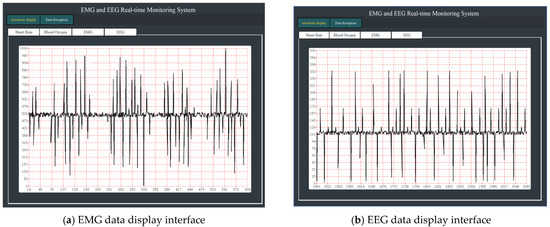 Design of a Real-Time Monitoring System for Electroencephalogram and ...