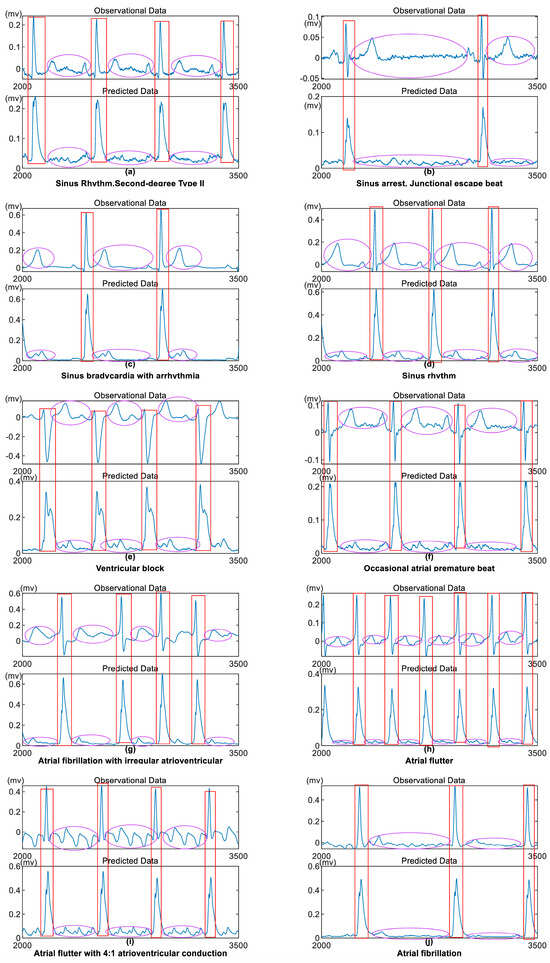 Electronics | Free Full-Text | An Algorithm for Initial Localization of Feature Waveforms Based ...