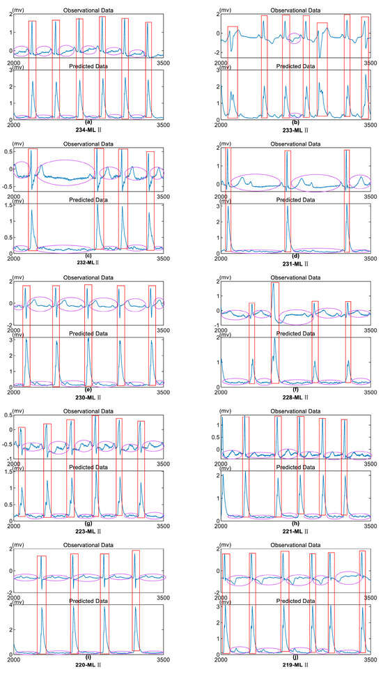 Electronics | Free Full-Text | An Algorithm for Initial Localization of Feature Waveforms Based ...