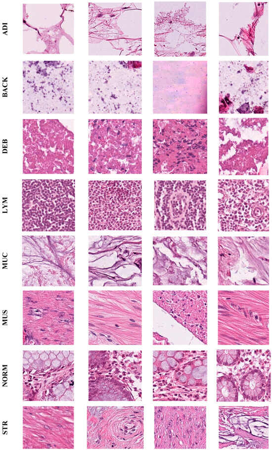 Adaptive Dynamic Learning Rate Optimization Technique for Colorectal ...