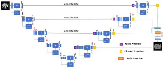 Innovative Noise Extraction and Denoising in Low-Dose CT Using a Supervised Deep Learning Framework