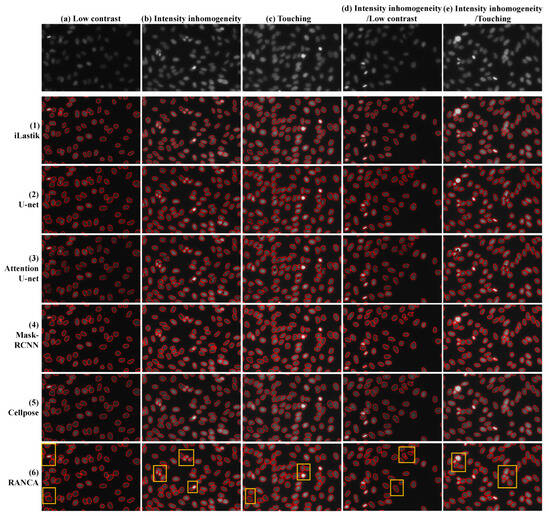 Regionally Adaptive Active Learning Framework for Nuclear Segmentation ...