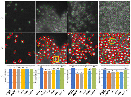 Regionally Adaptive Active Learning Framework for Nuclear Segmentation ...