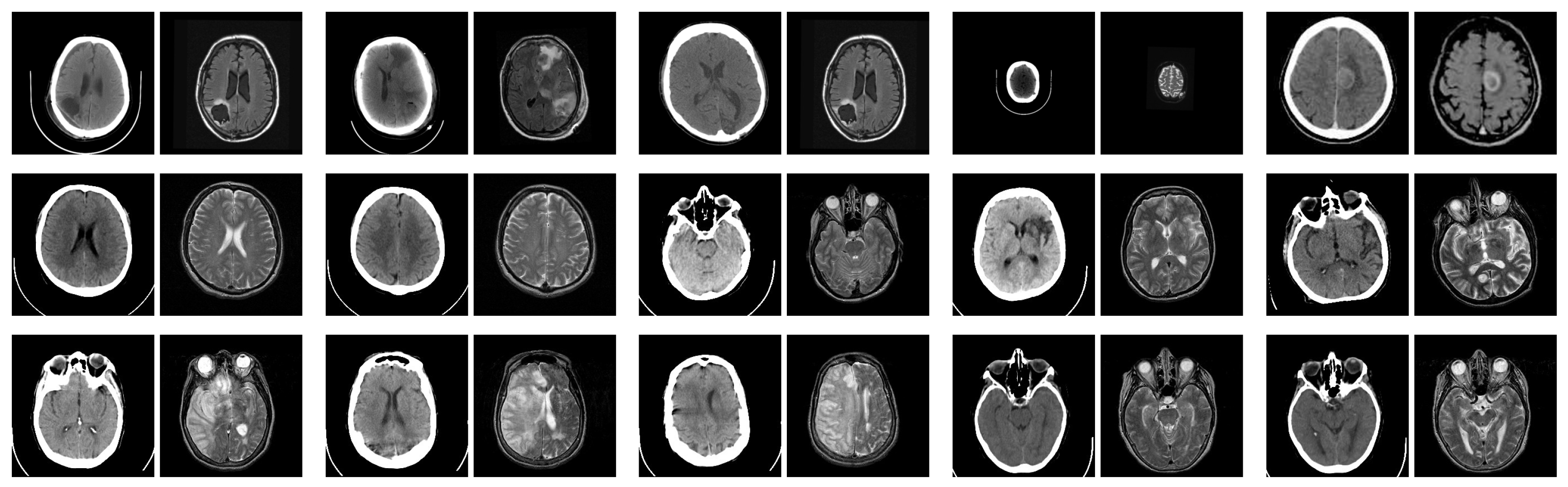 CT and MRI Image Fusion via Coupled Feature-Learning GAN