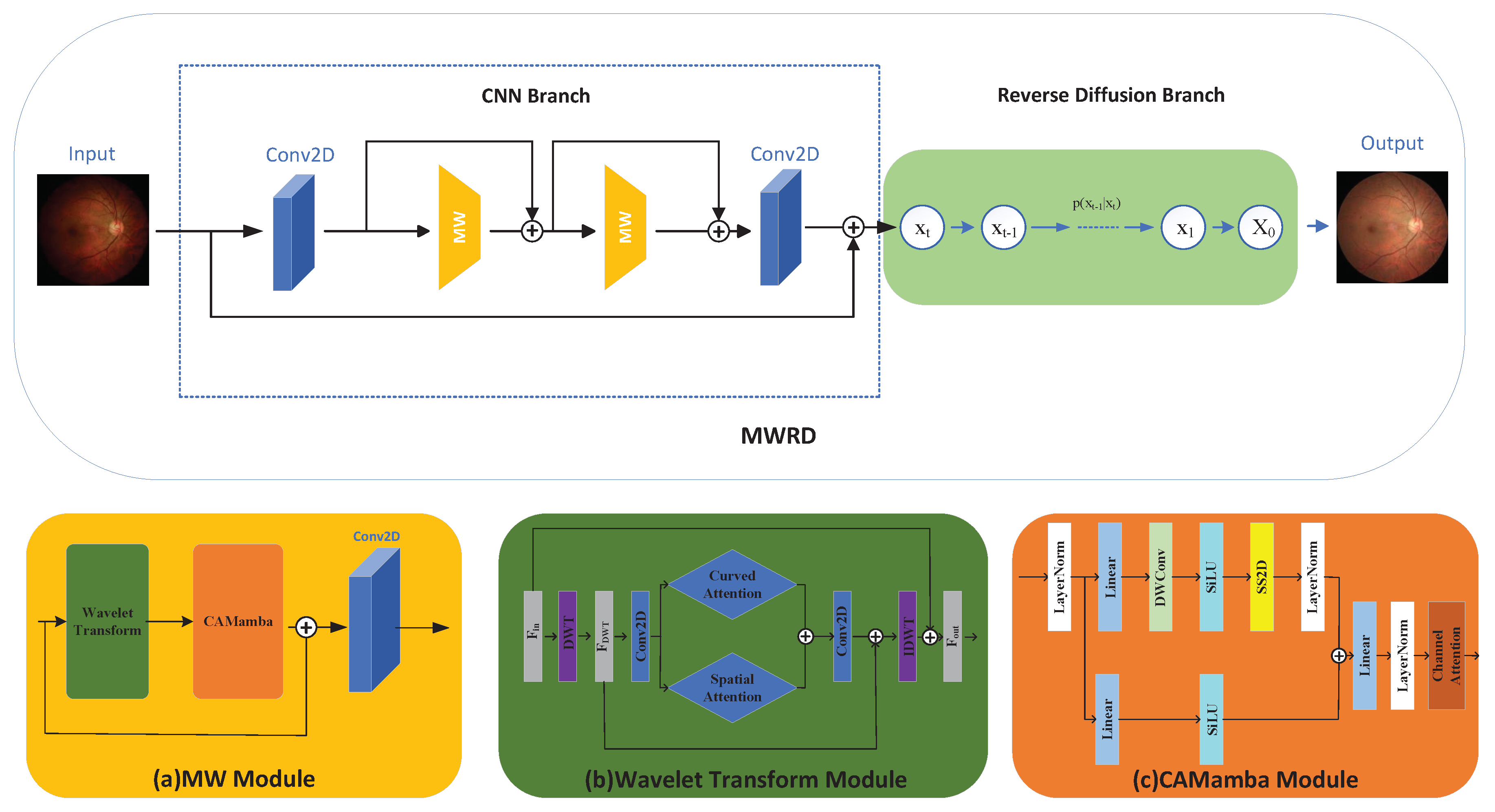 MWRD (Mamba Wavelet Reverse Diffusion)—An Efficient Fundus Image ...