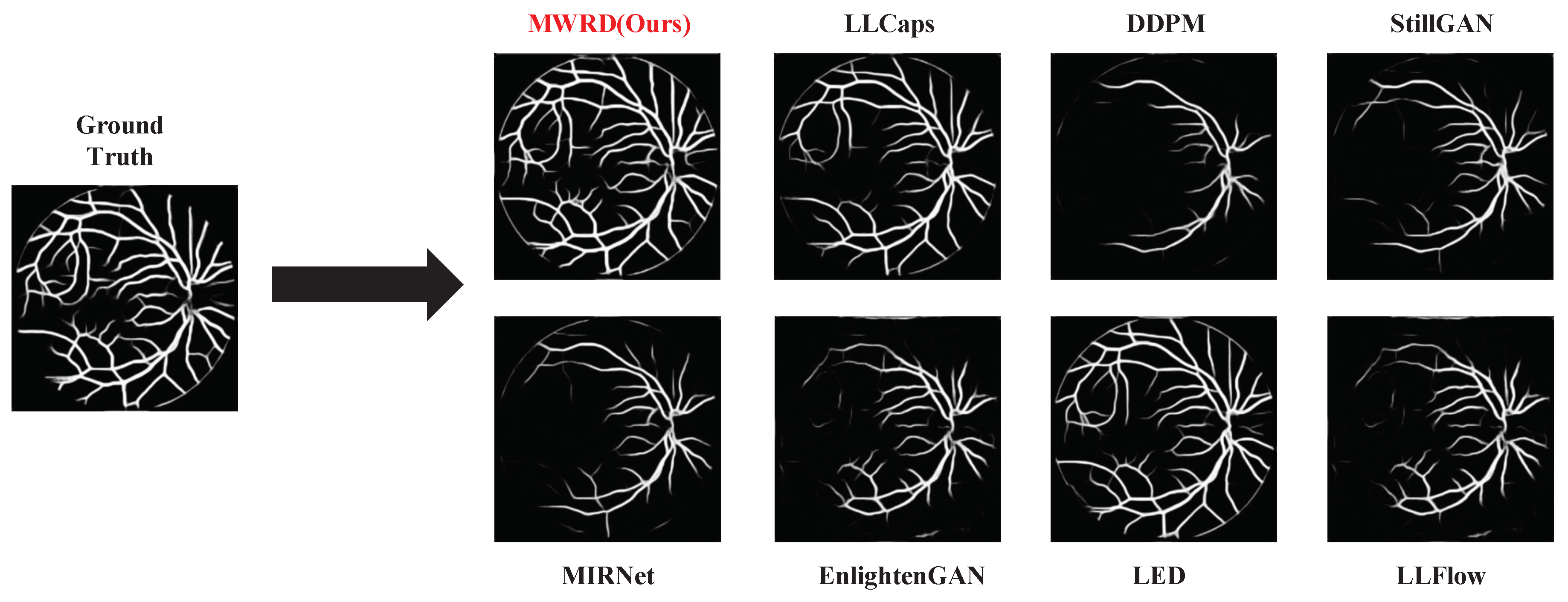 MWRD (Mamba Wavelet Reverse Diffusion)—An Efficient Fundus Image Enhancement Network Based on an ...