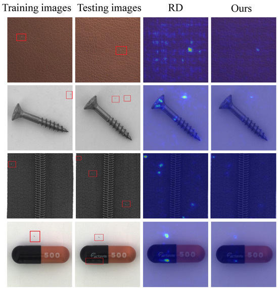 Unsupervised Anomaly Detection via Normal Feature-Enhanced Reverse ...