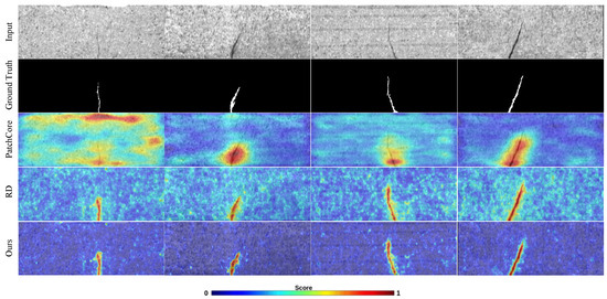 Unsupervised Anomaly Detection via Normal Feature-Enhanced Reverse ...