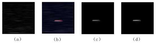 Millimeter-Wave Radar Clutter Suppression Based on Cycle-Consistency Generative Adversarial Network