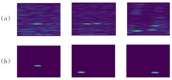 Millimeter-Wave Radar Clutter Suppression Based on Cycle-Consistency ...