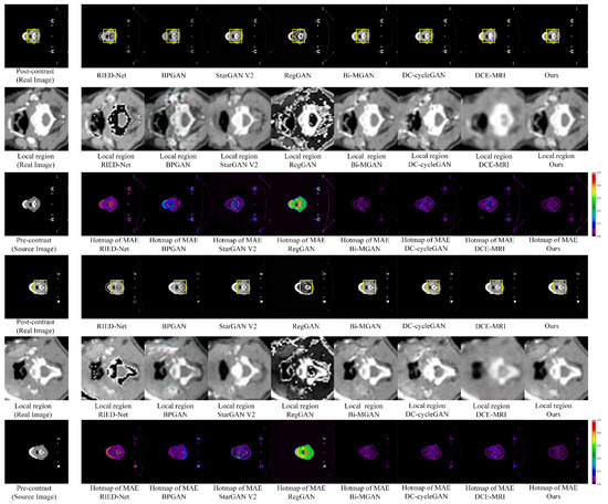 IFGAN: Pre- to Post-Contrast Medical Image Synthesis Based on ...