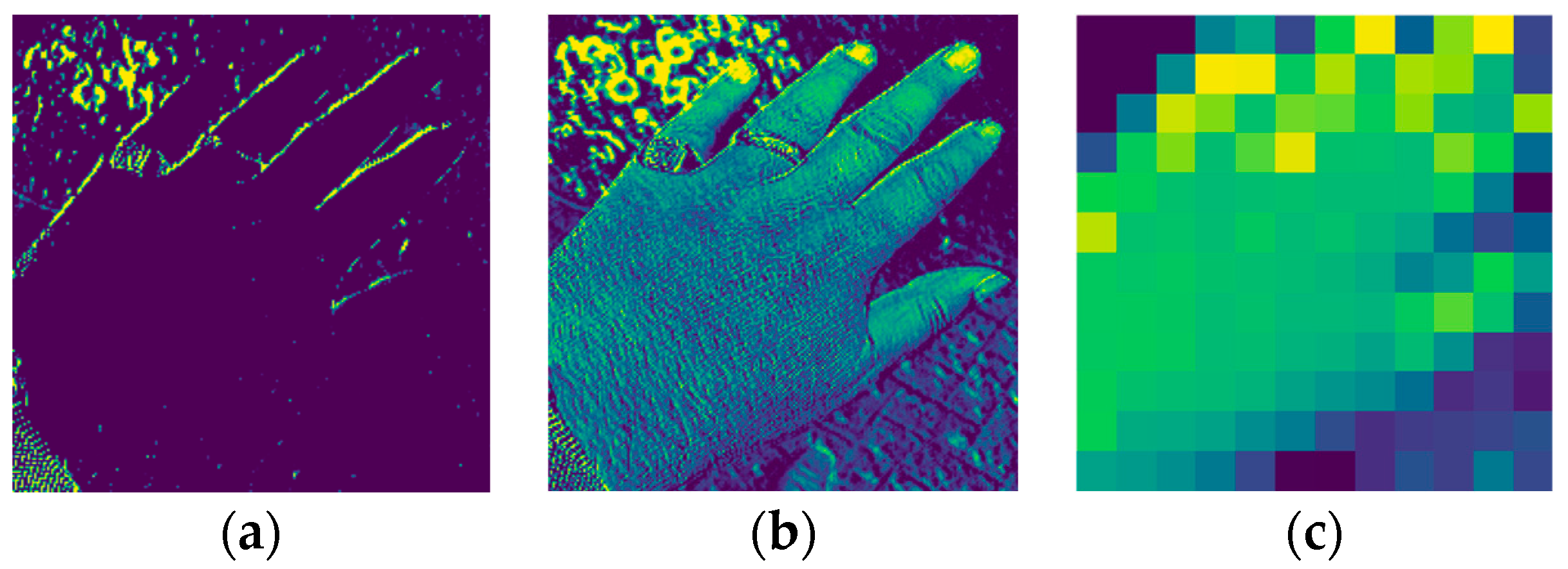 Using Deep Learning, Optuna, and Digital Images to Identify Necrotizing Fasciitis