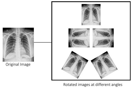 Deep Learning Approaches for Chest Radiograph Interpretation: A ...