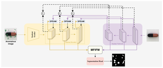 A Refined Knowledge Distillation Network for Unsupervised Anomaly Detection