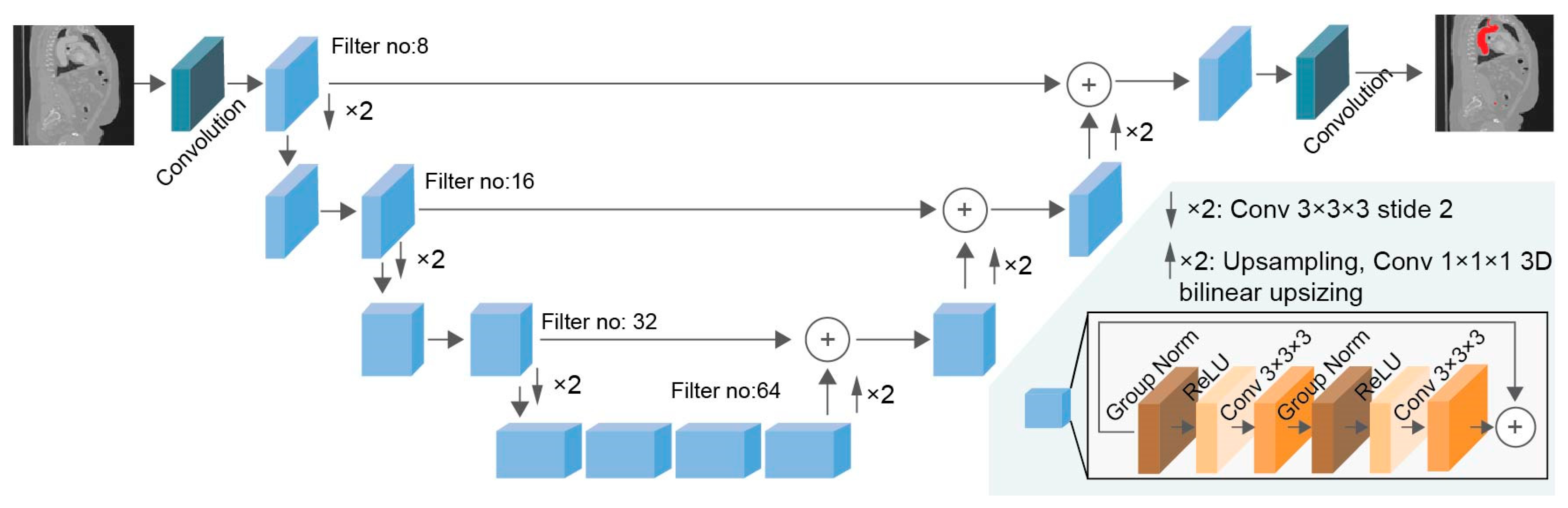 Automatic Segmentation in 3D CT Images: A Comparative Study of Deep ...