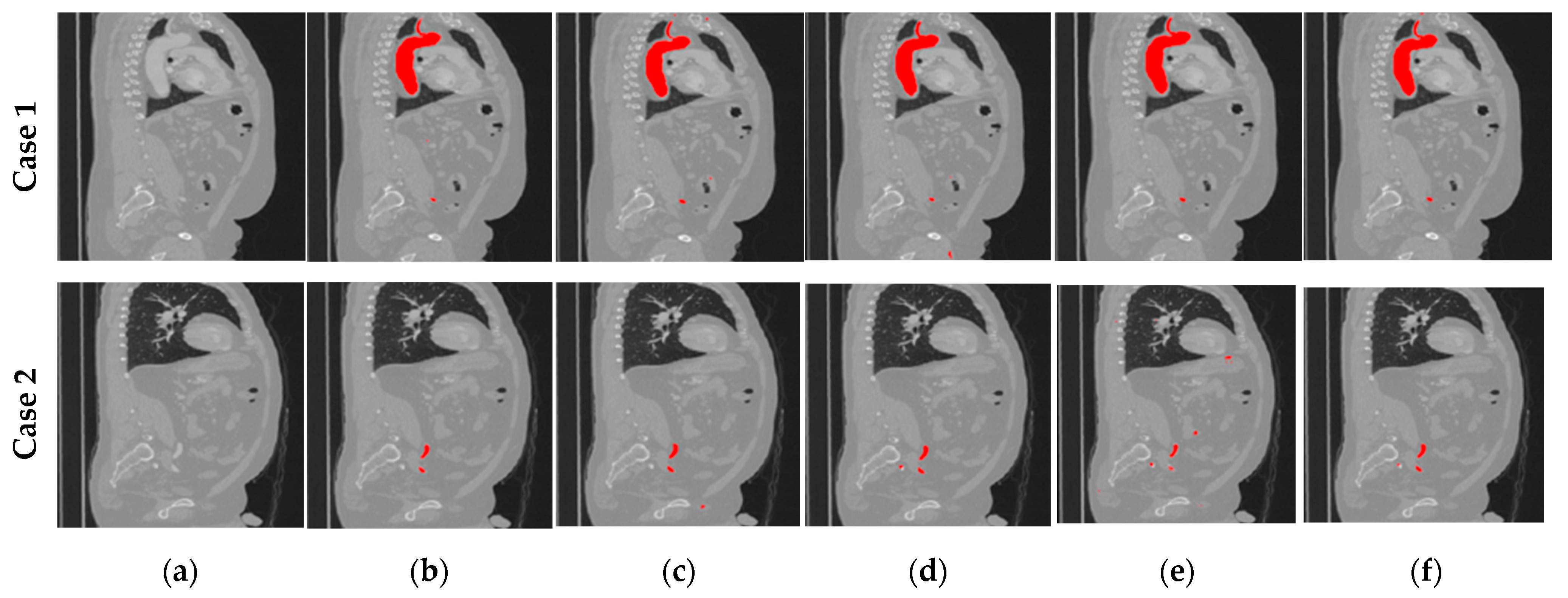 Automatic Segmentation in 3D CT Images: A Comparative Study of Deep ...
