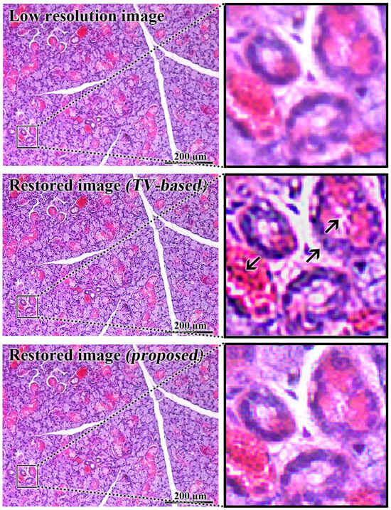 Investigation of a Robust Blind Deconvolution Algorithm Using Extracted Structures in Light ...