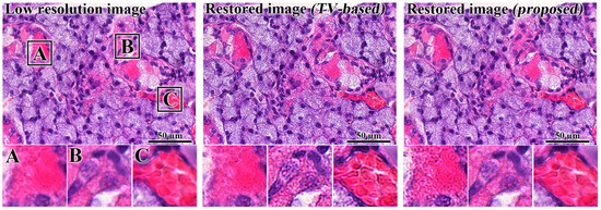 Investigation of a Robust Blind Deconvolution Algorithm Using Extracted Structures in Light ...