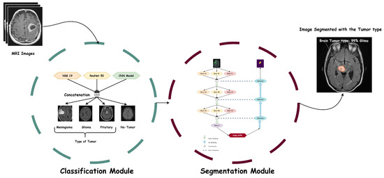 MPB-UNet: Multi-Parallel Blocks UNet for MRI Automated Brain Tumor Segmentation