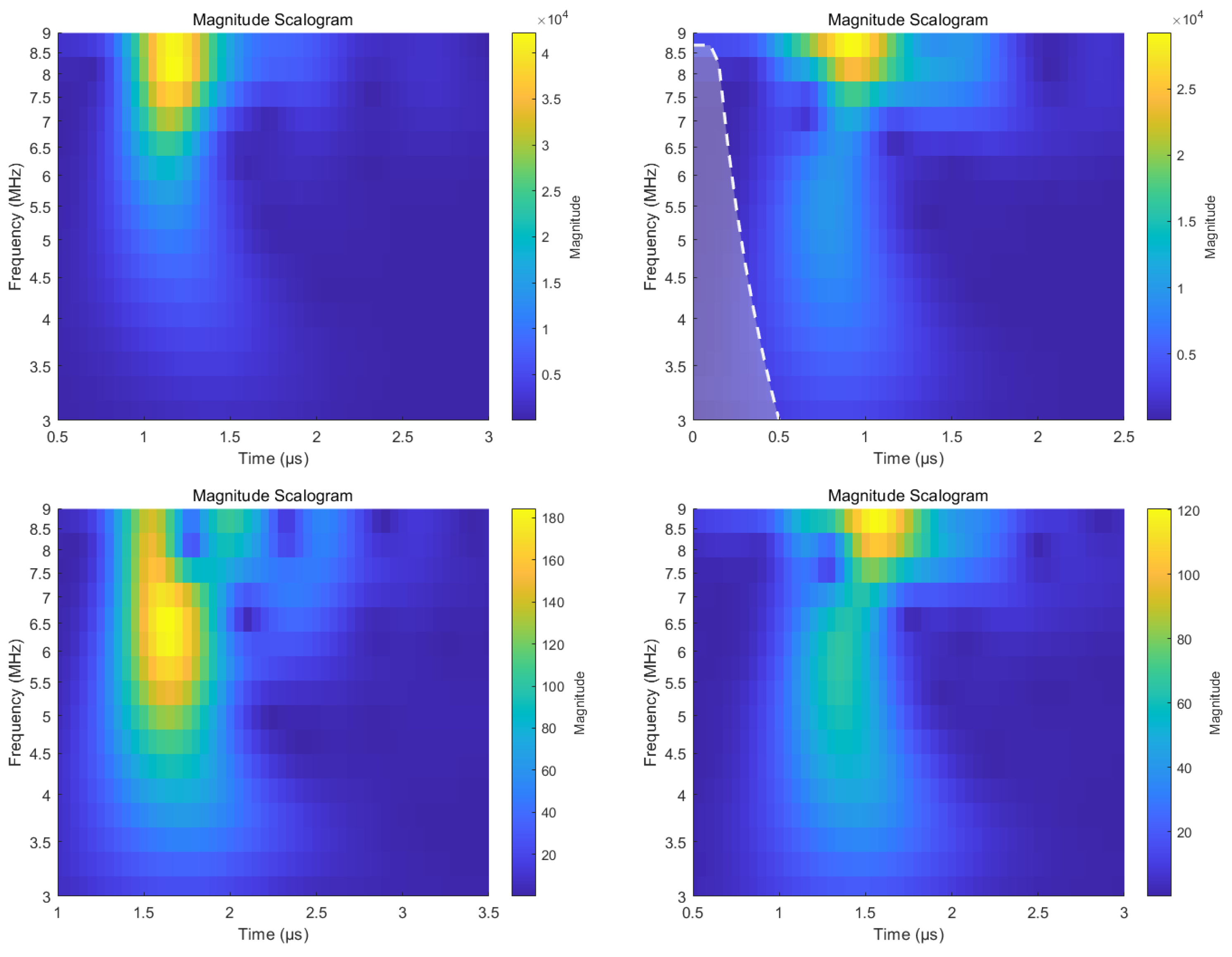 Partial Discharge Recognition of Transformers Based on Data Augmentation and CNN-BiLSTM ...