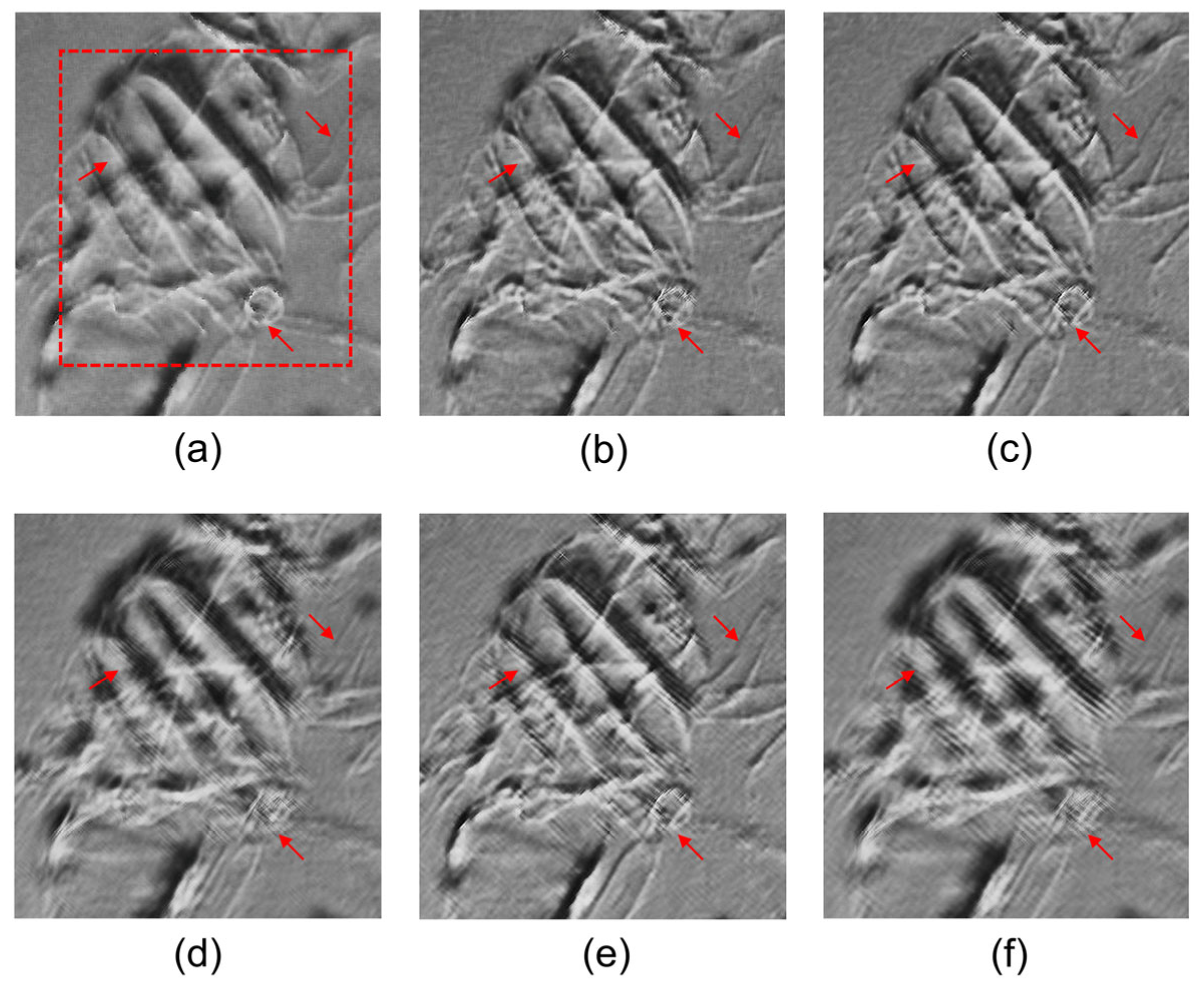 Feature-Level Image Fusion Scheme for X-Ray Multi-Contrast Imaging