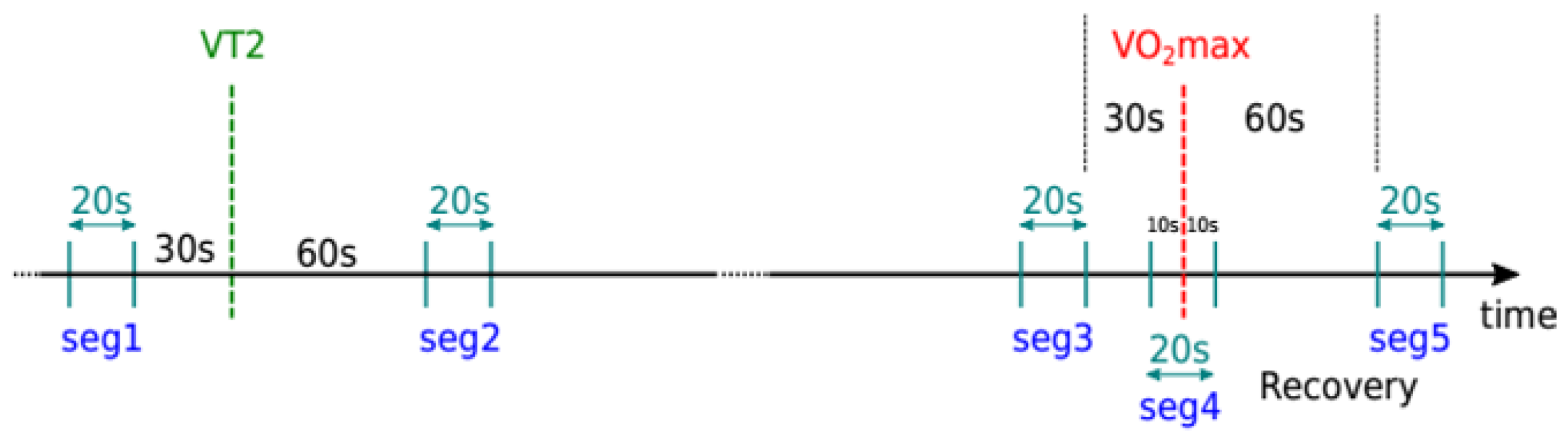 Exercise ECG Classification Based on Novel R-Peak Detection Using ...