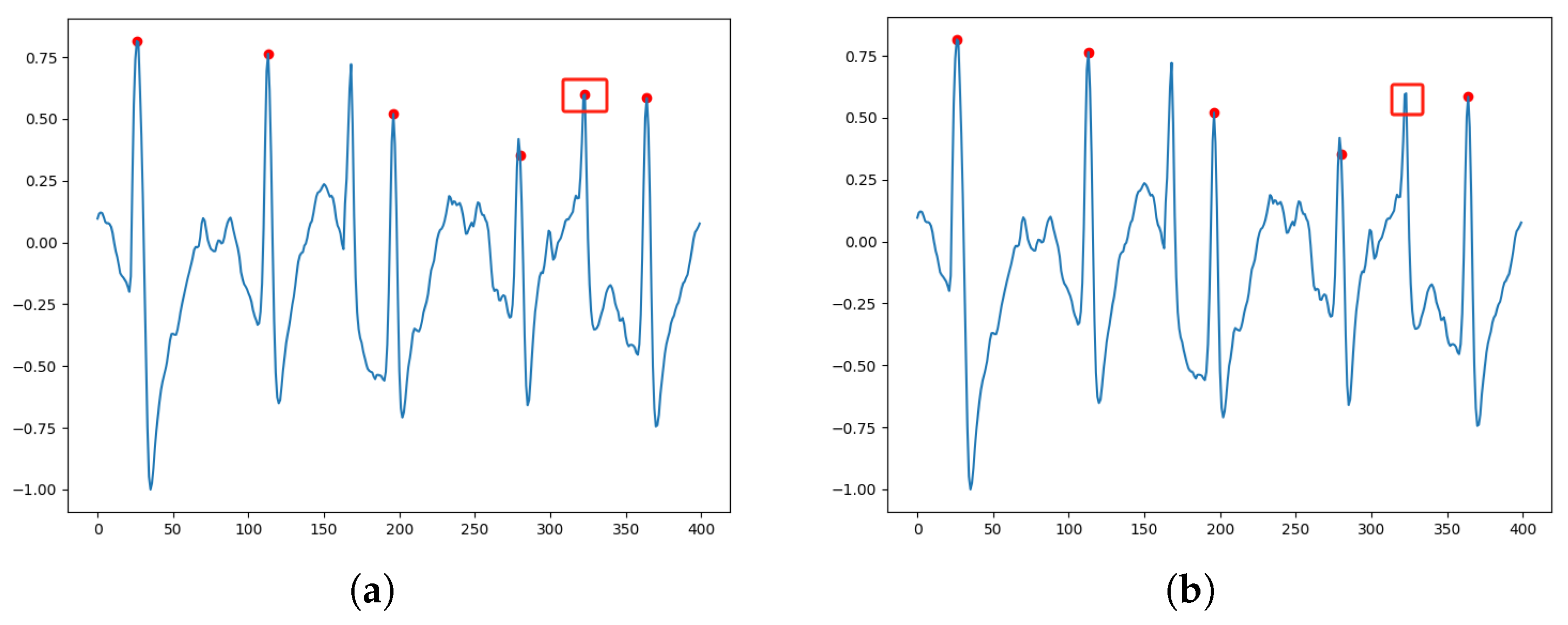 Exercise ECG Classification Based on Novel R-Peak Detection Using ...