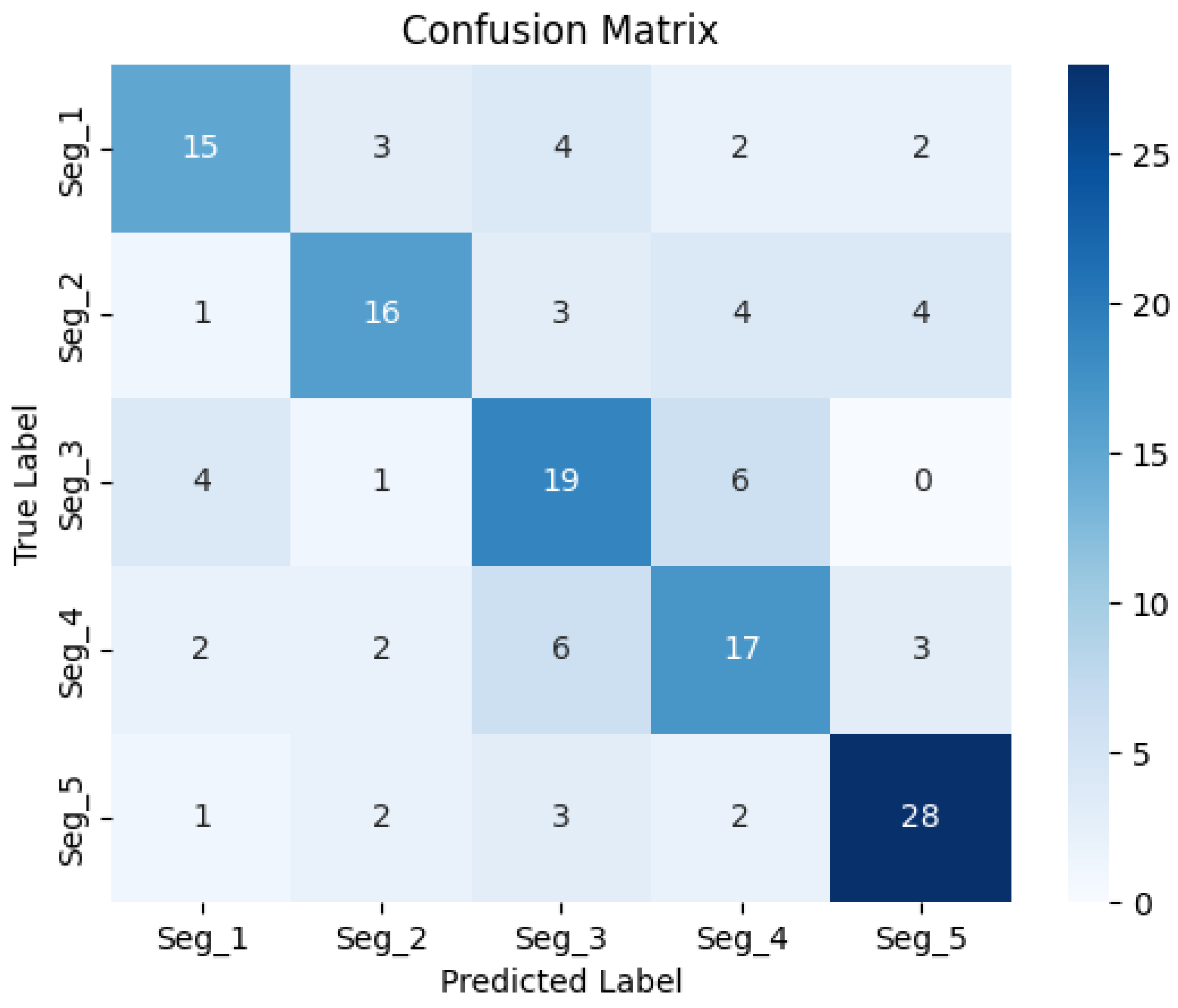 Exercise ECG Classification Based on Novel R-Peak Detection Using ...
