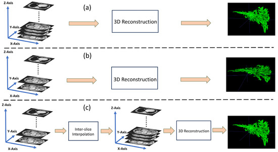 W-Shaped Net: An Inter-Slice Super-Resolution Segmentation Deep Network ...