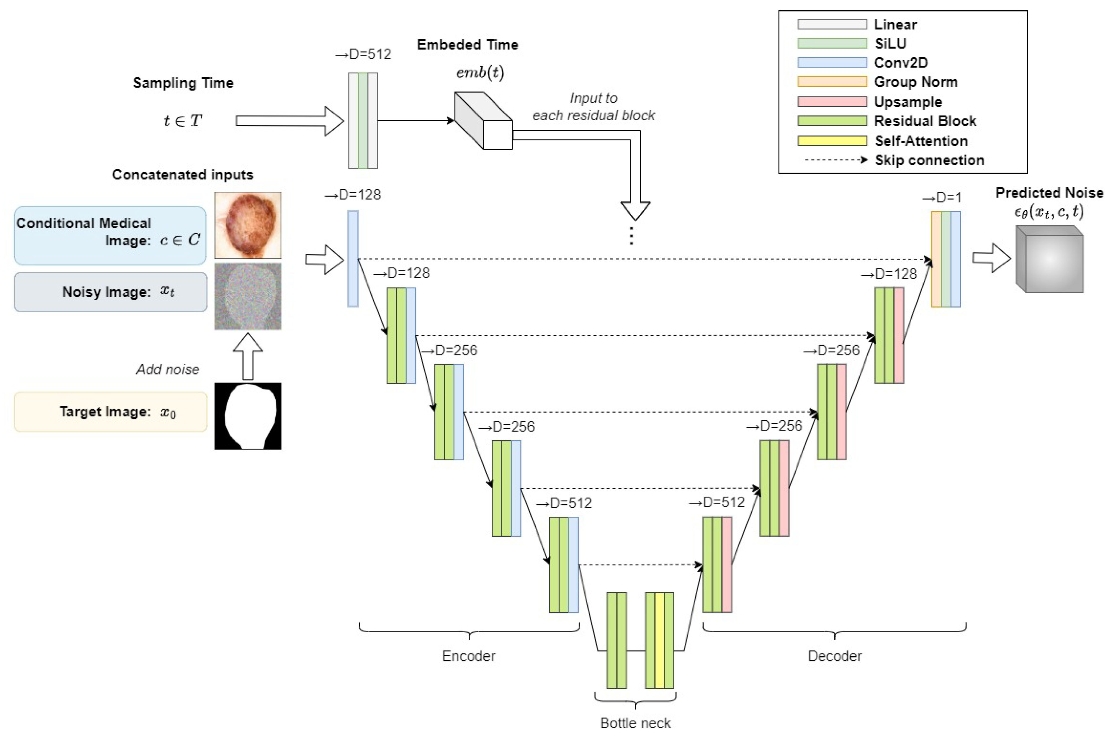 Lightweight Denoising Diffusion Implicit Model for Medical Segmentation
