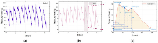 Non-Invasive Blood Pressure Estimation Using Multi-Domain Pulse Wave ...