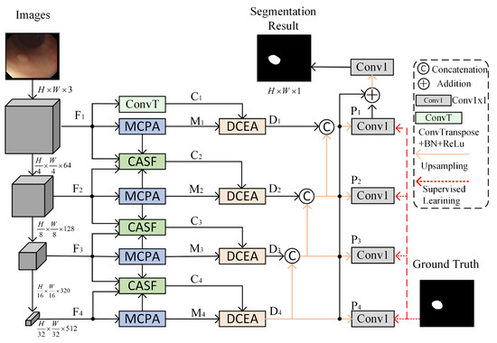 Polyp Segmentation Algorithm Based on the Dual Attention and Fusion Mechanism