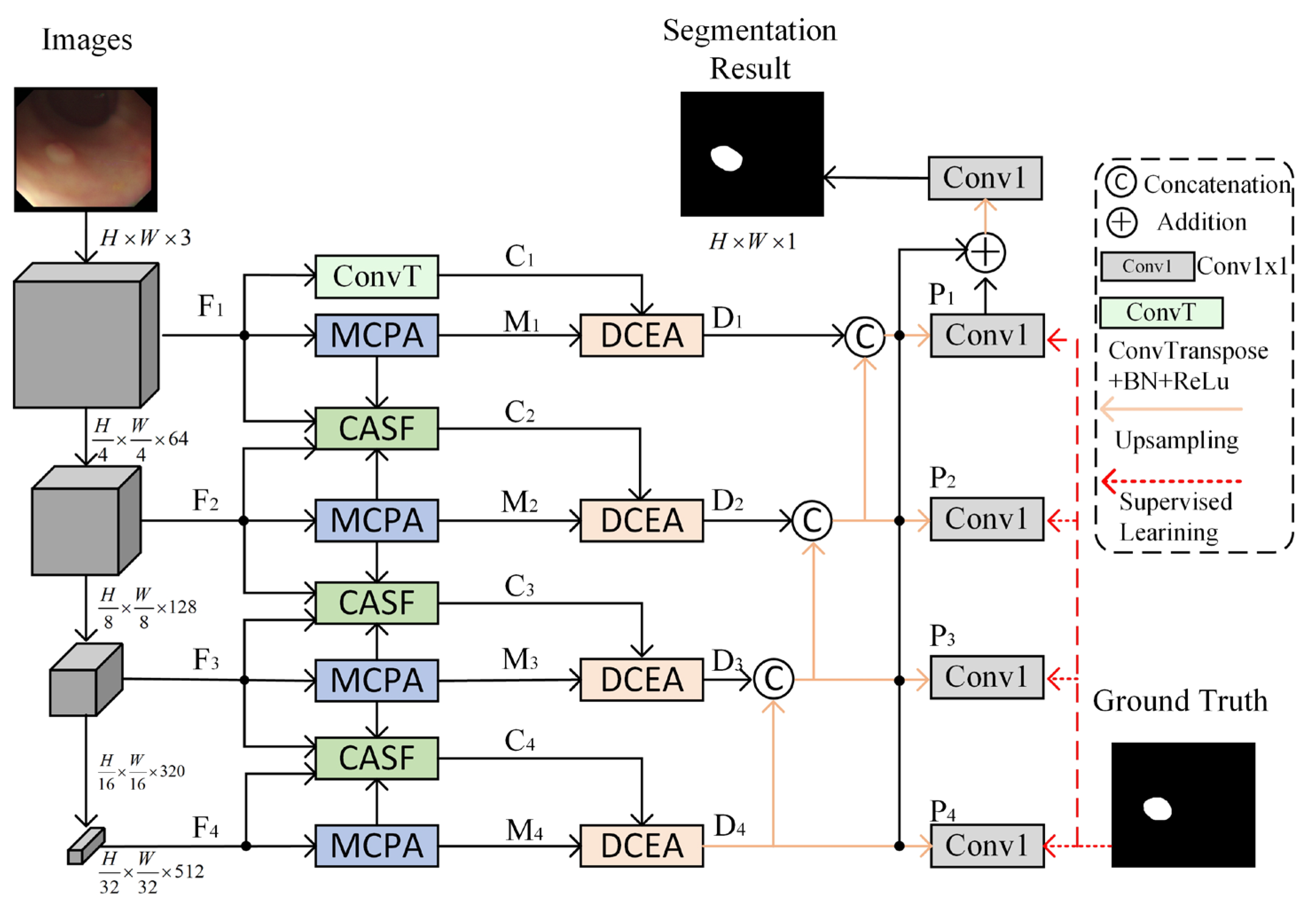 Polyp Segmentation Algorithm Based on the Dual Attention and Fusion Mechanism