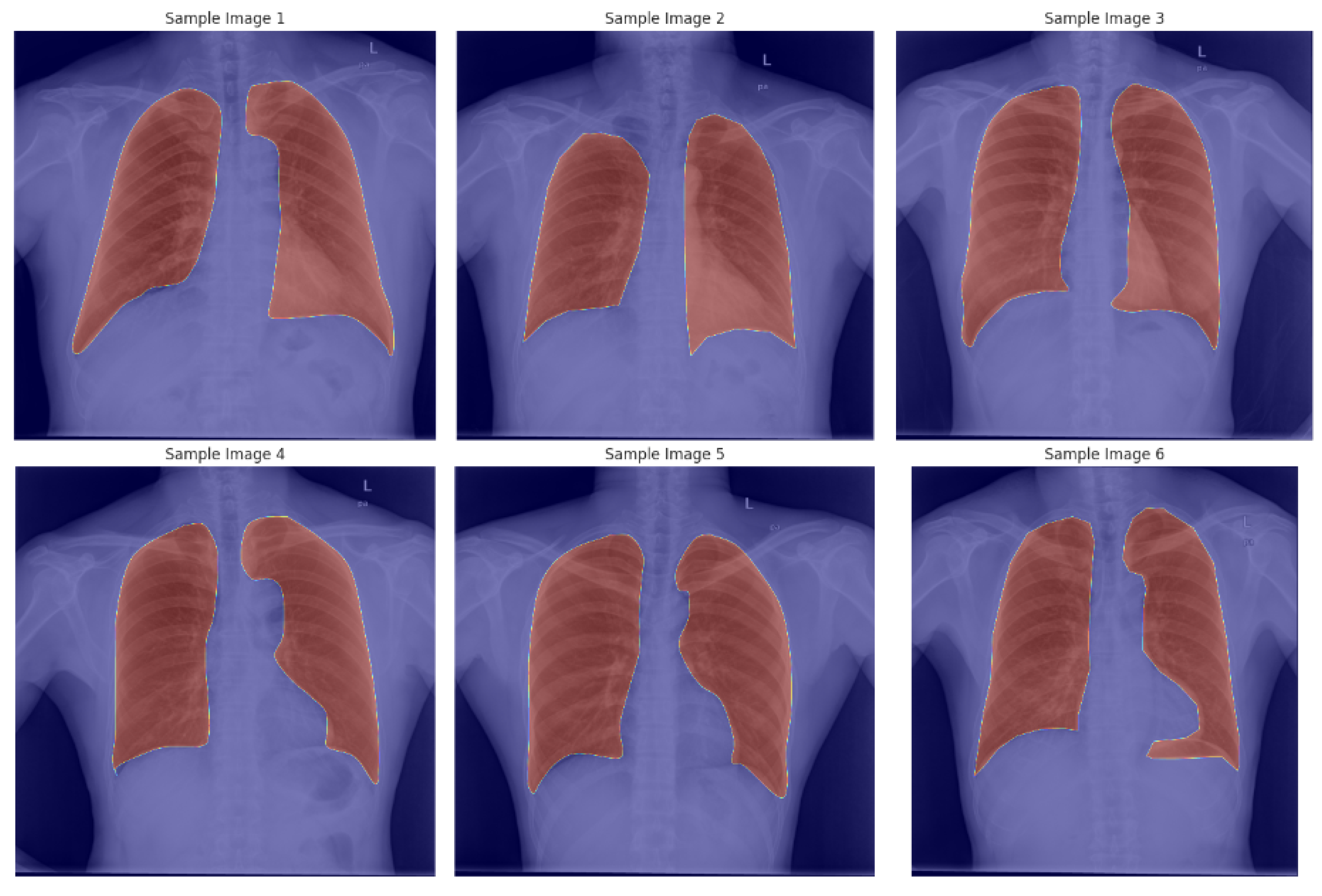 LSE-Net: Integrated Segmentation and Ensemble Deep Learning for ...