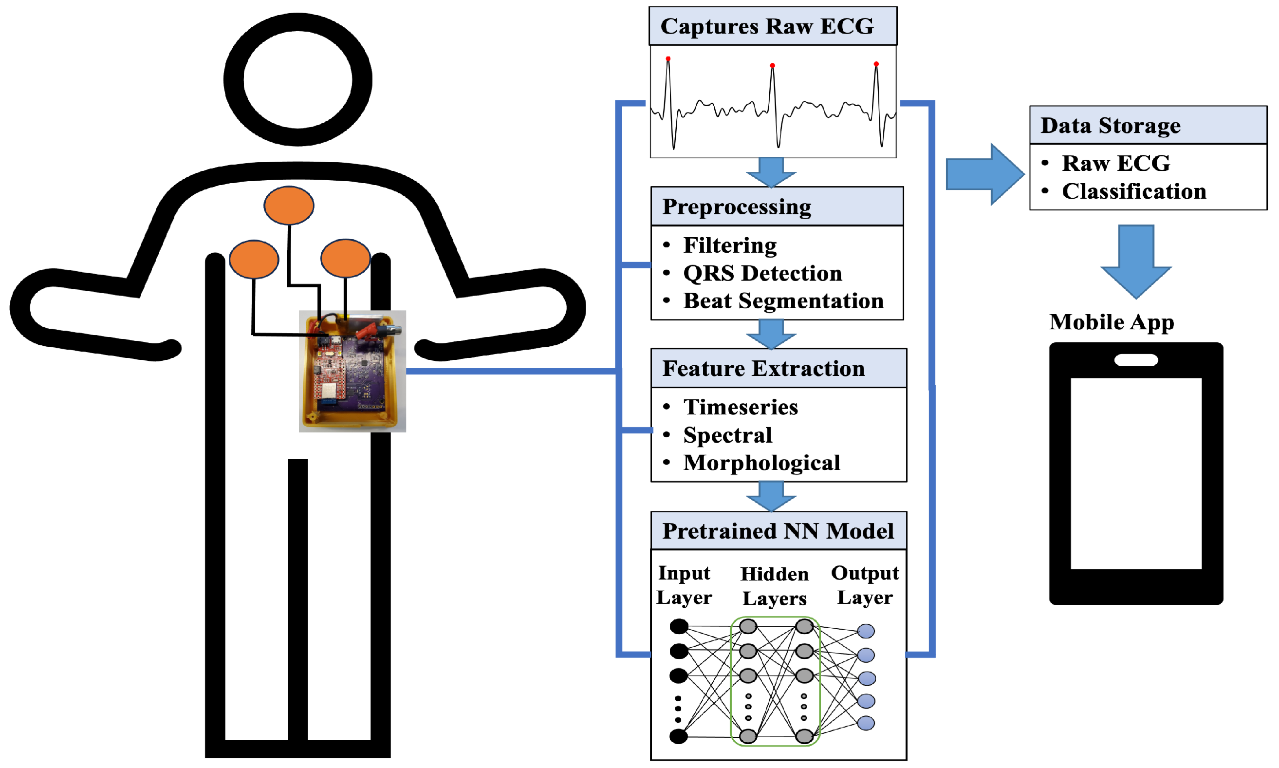 Resource-Constrained On-Chip AI Classifier for Beat-by-Beat Real-Time Arrhythmia Detection with ...