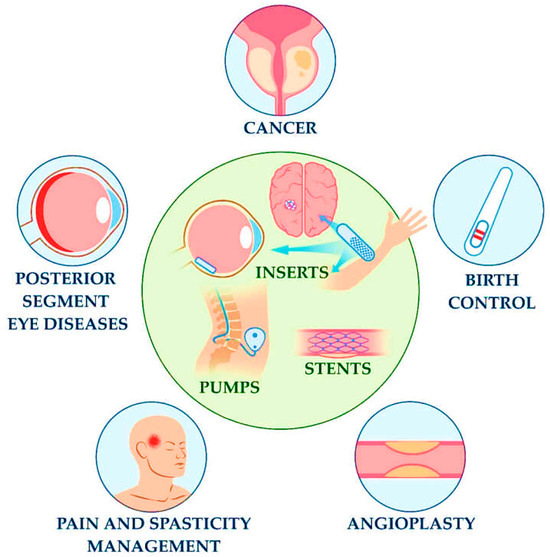 Biochips on the Move: Emerging Trends in Wearable and Implantable Lab ...