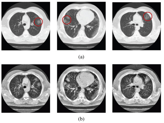 Encyclopedia | Free Full-Text | Entropy