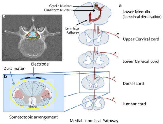 Painful Legs and Moving Toes