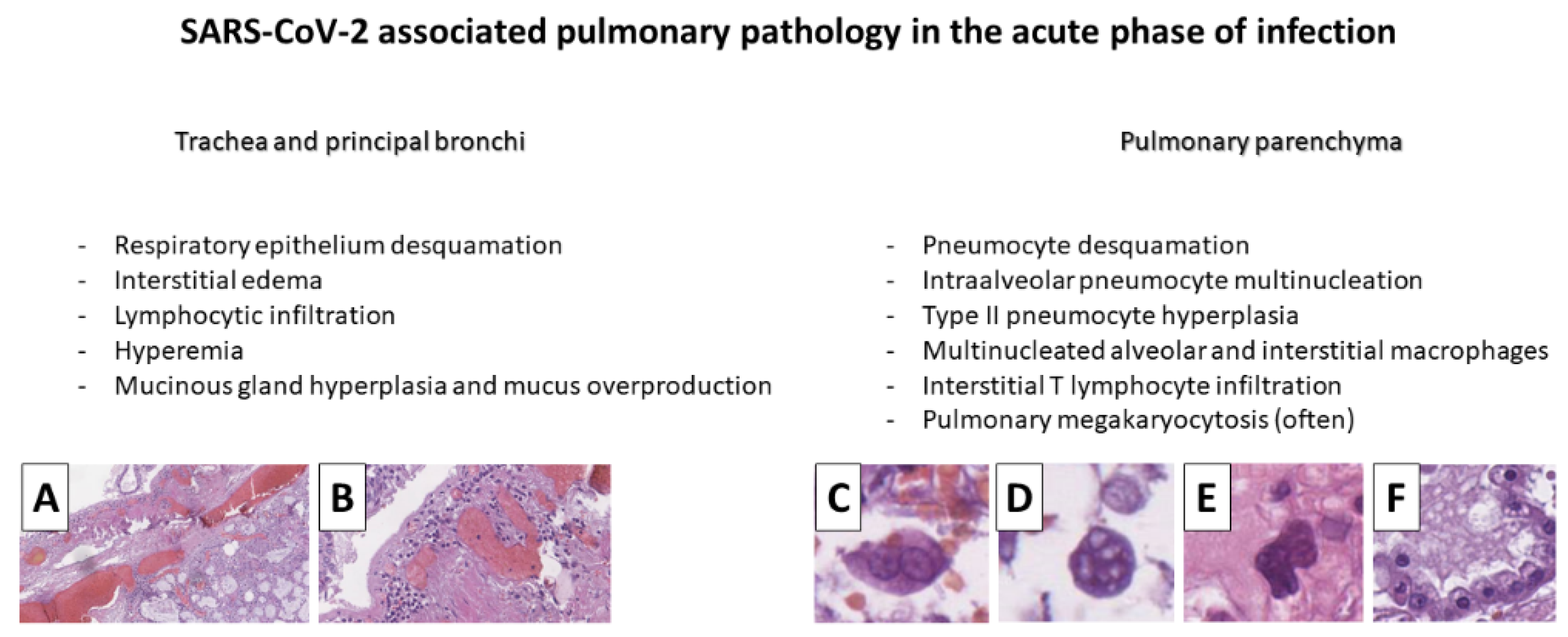 SARS-CoV-2 Associated Pulmonary Pathology