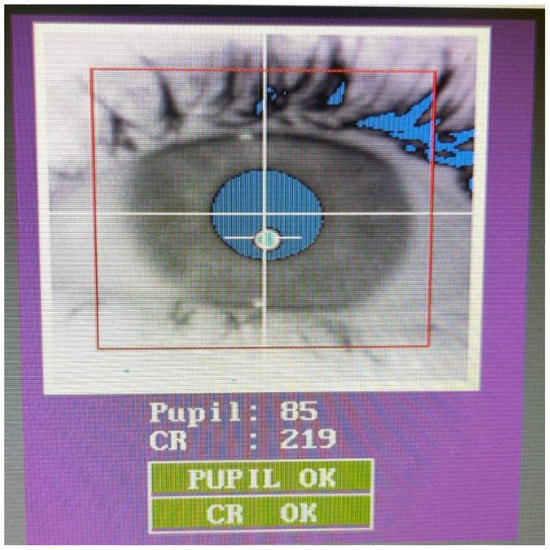 Tracking Eye Movements as a Window on Language Processing: The Visual ...