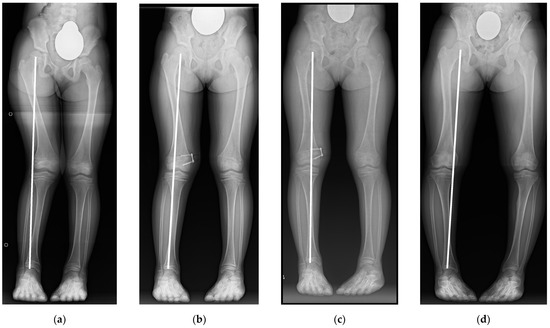 Endocrines | An Open Access Journal from MDPI