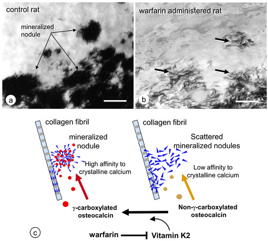 Histological Assessment of Endochondral Ossification and Bone ...