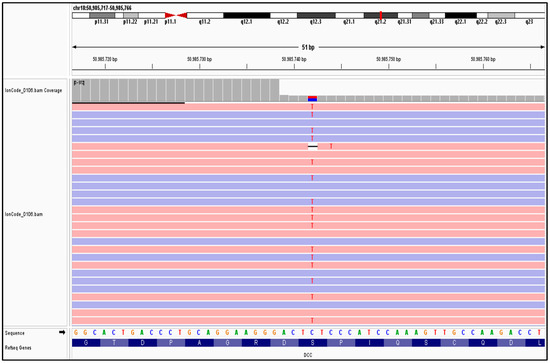 Adult-Onset Case of Female Idiopathic Hypogonadotropic Hypogonadism and ...