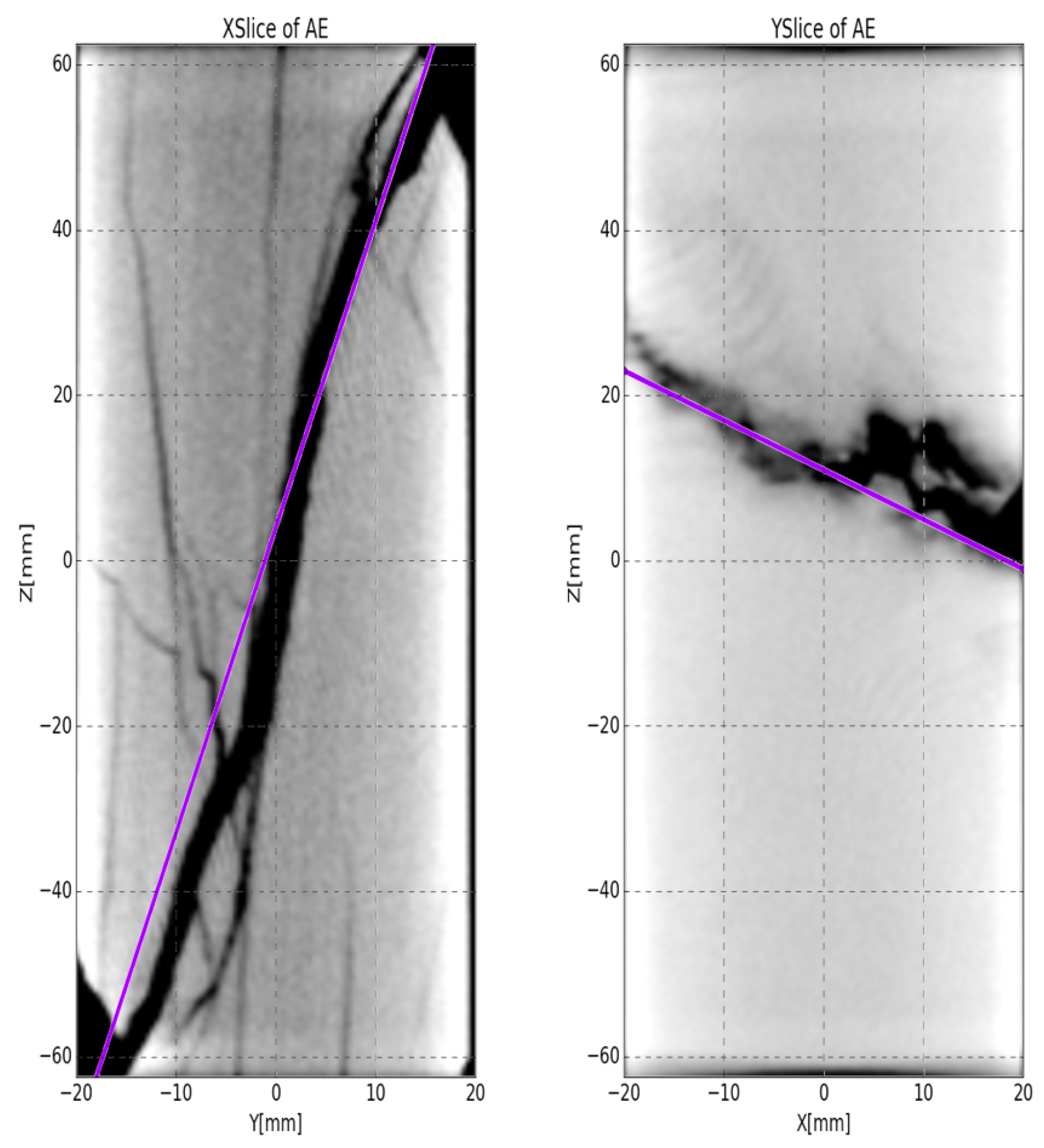 Automatic Identification of Fractures Using a Density-Based Clustering Algorithm with Time ...